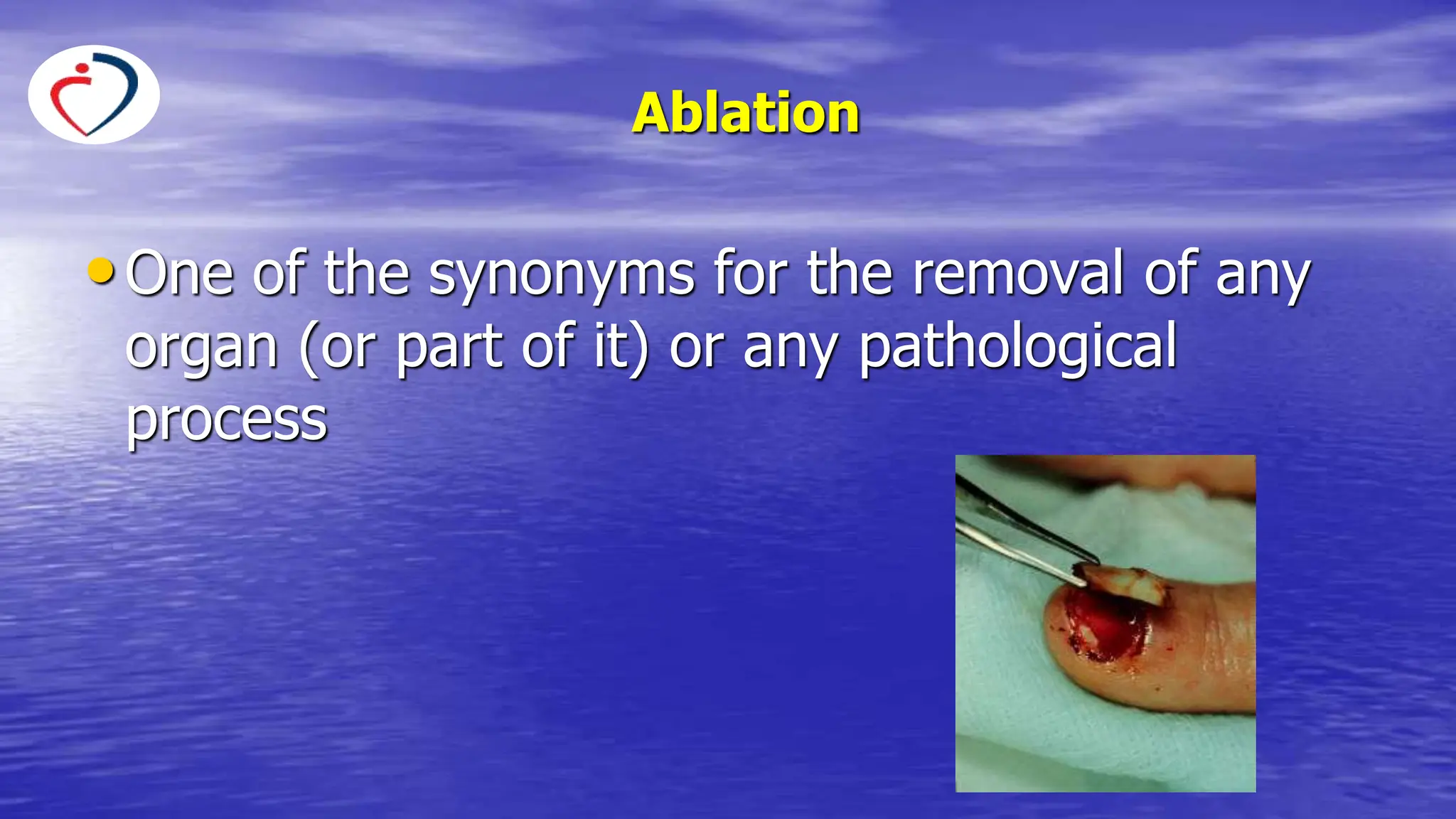 Surgical terminology and types of surgical interventions.pptx
