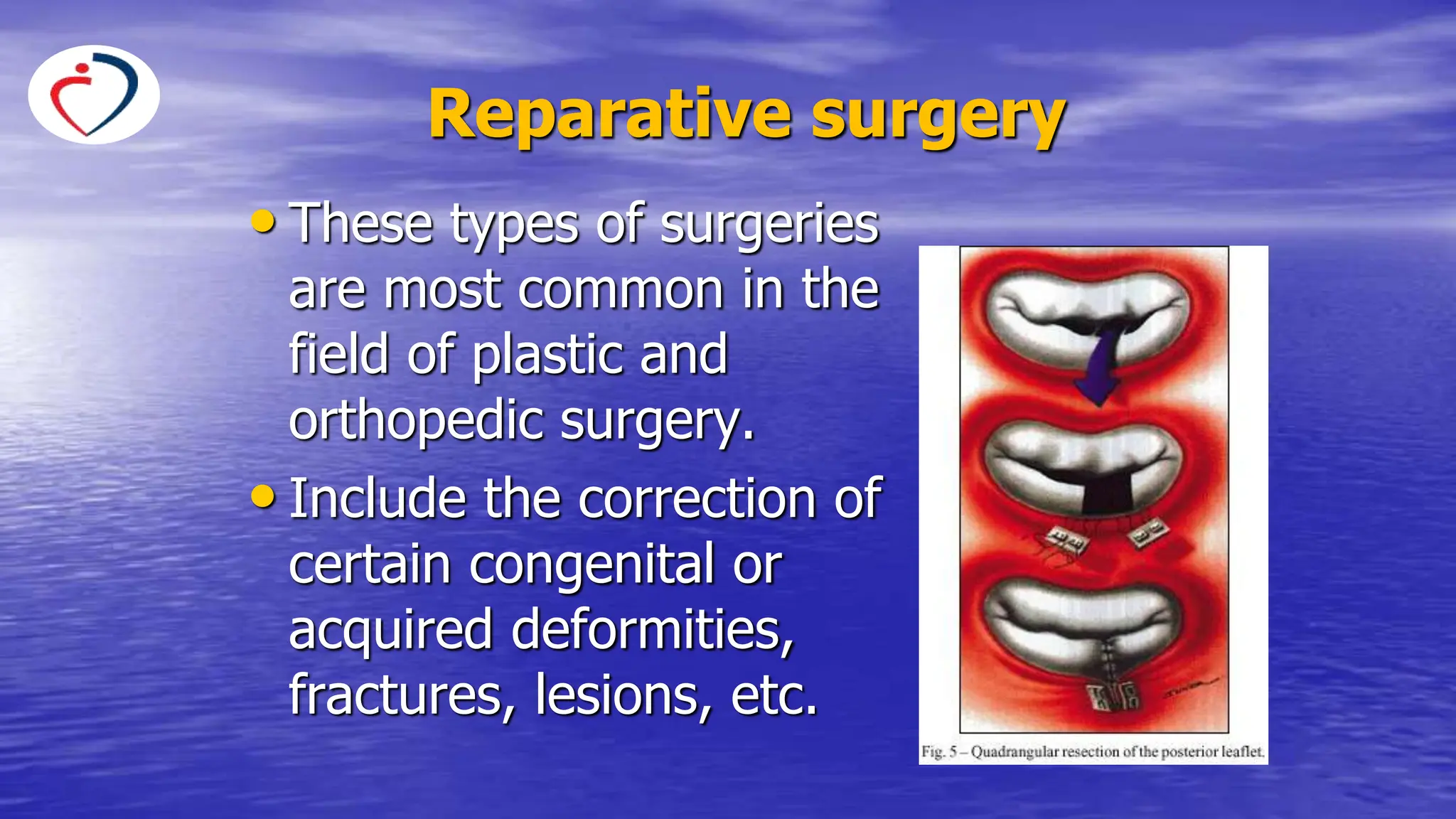 Surgical terminology and types of surgical interventions.pptx