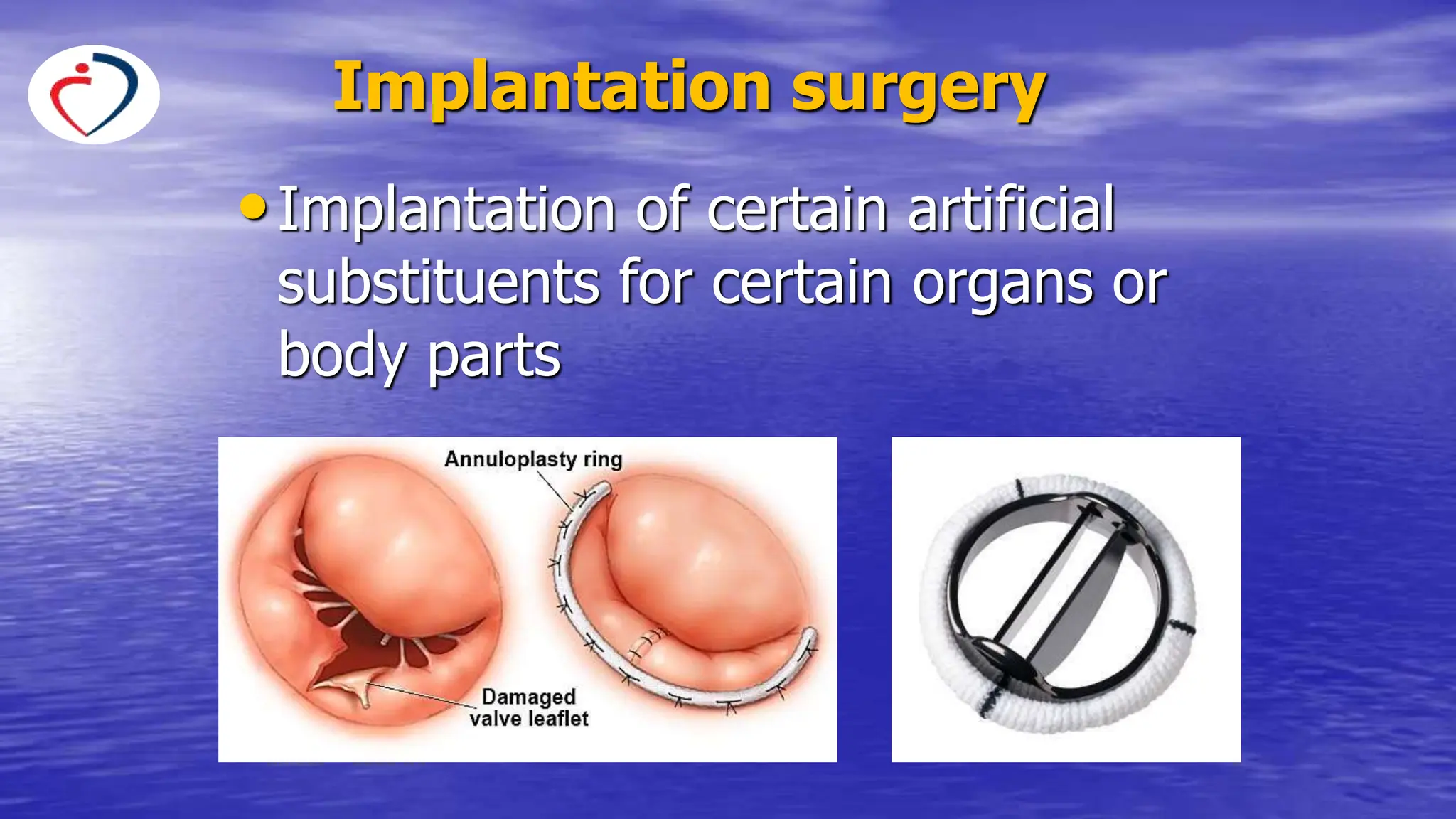 Surgical terminology and types of surgical interventions.pptx