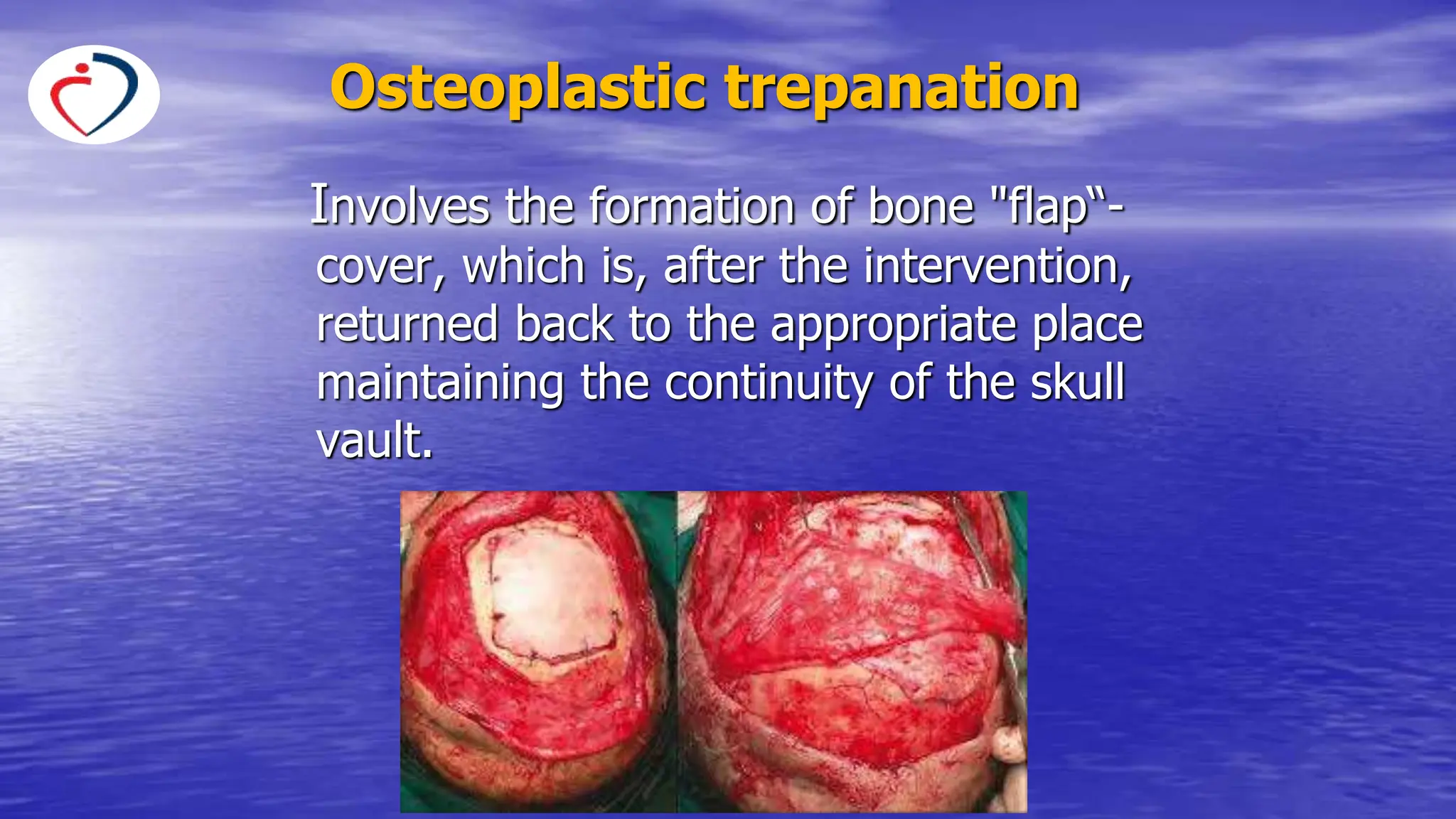 Surgical terminology and types of surgical interventions.pptx