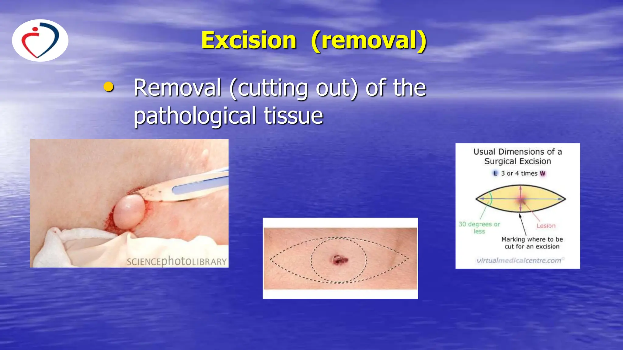 Surgical terminology and types of surgical interventions.pptx