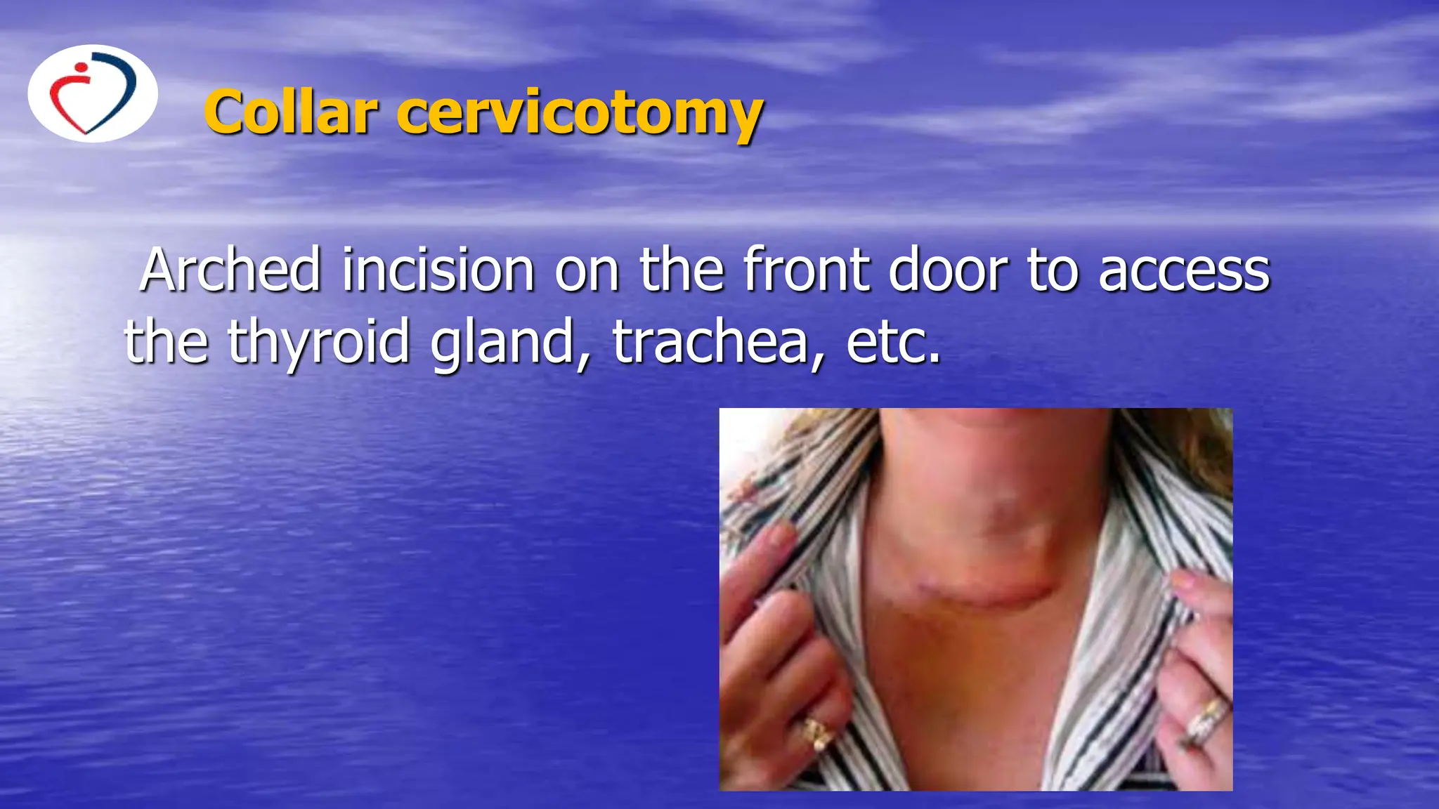 Surgical terminology and types of surgical interventions.pptx