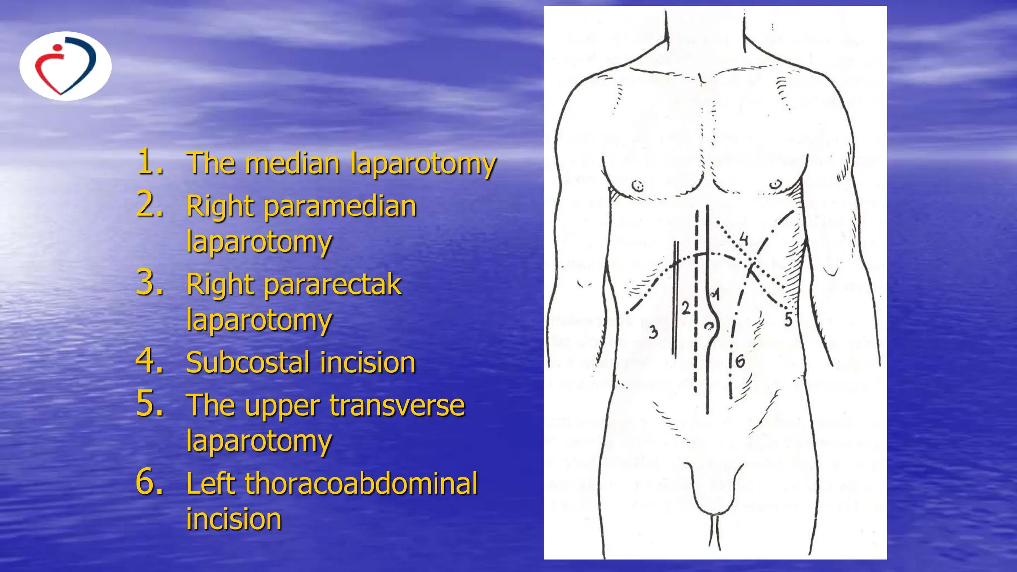 Surgical terminology and types of surgical interventions.pptx