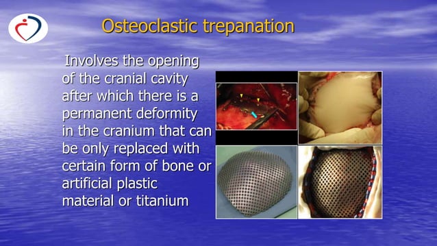 Surgical terminology and types of surgical interventions.pptx