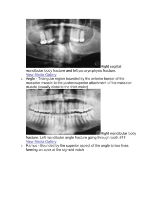Surgical therapy | PDF