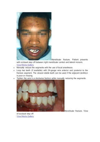Surgical therapy | DOCX