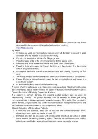 Surgical therapy | PDF