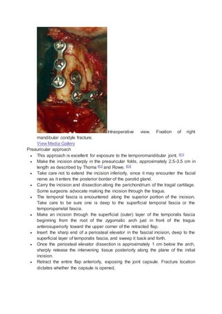 Surgical therapy | PDF