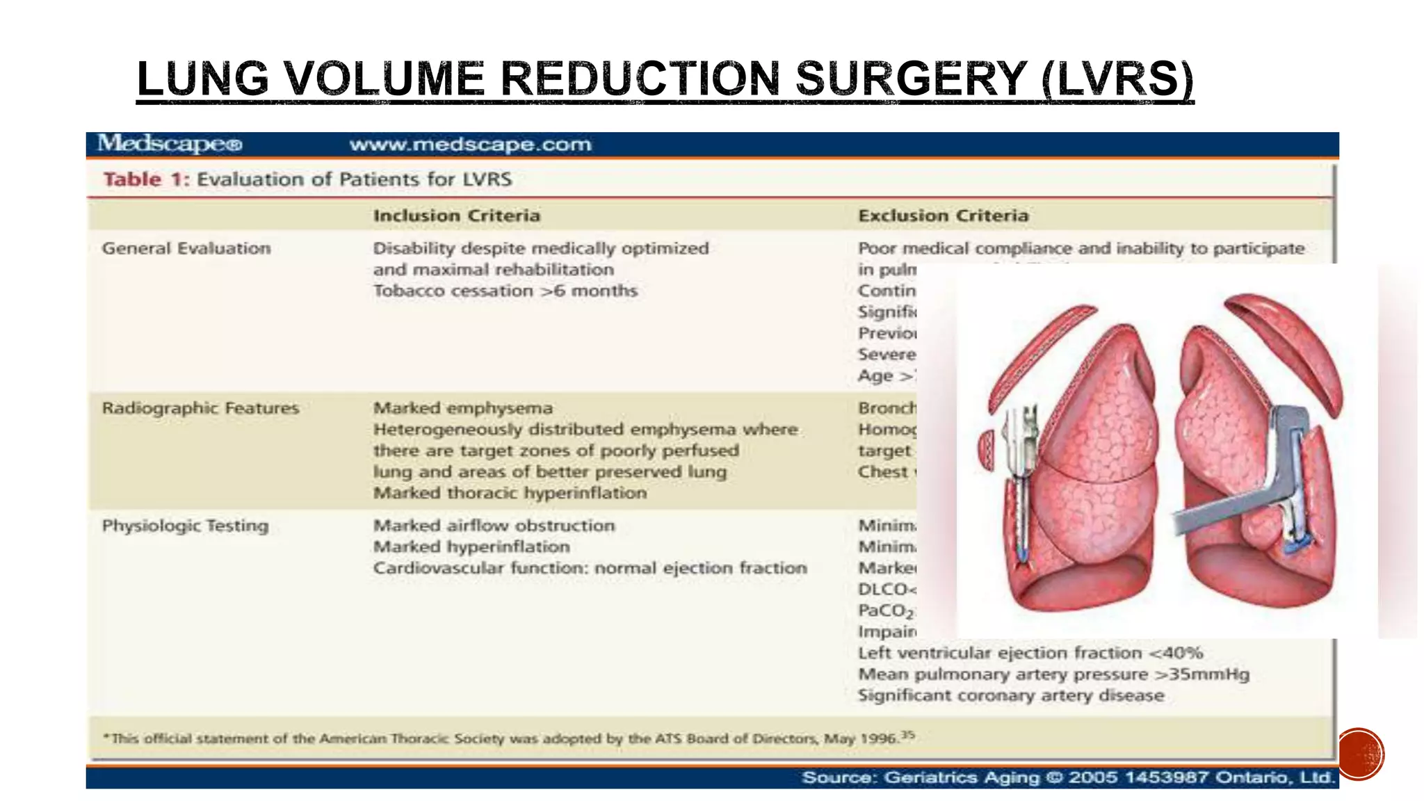 Surgical therapy in copd | PPTX