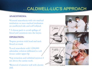 Surgical treatment chronic sinusitis | PPT