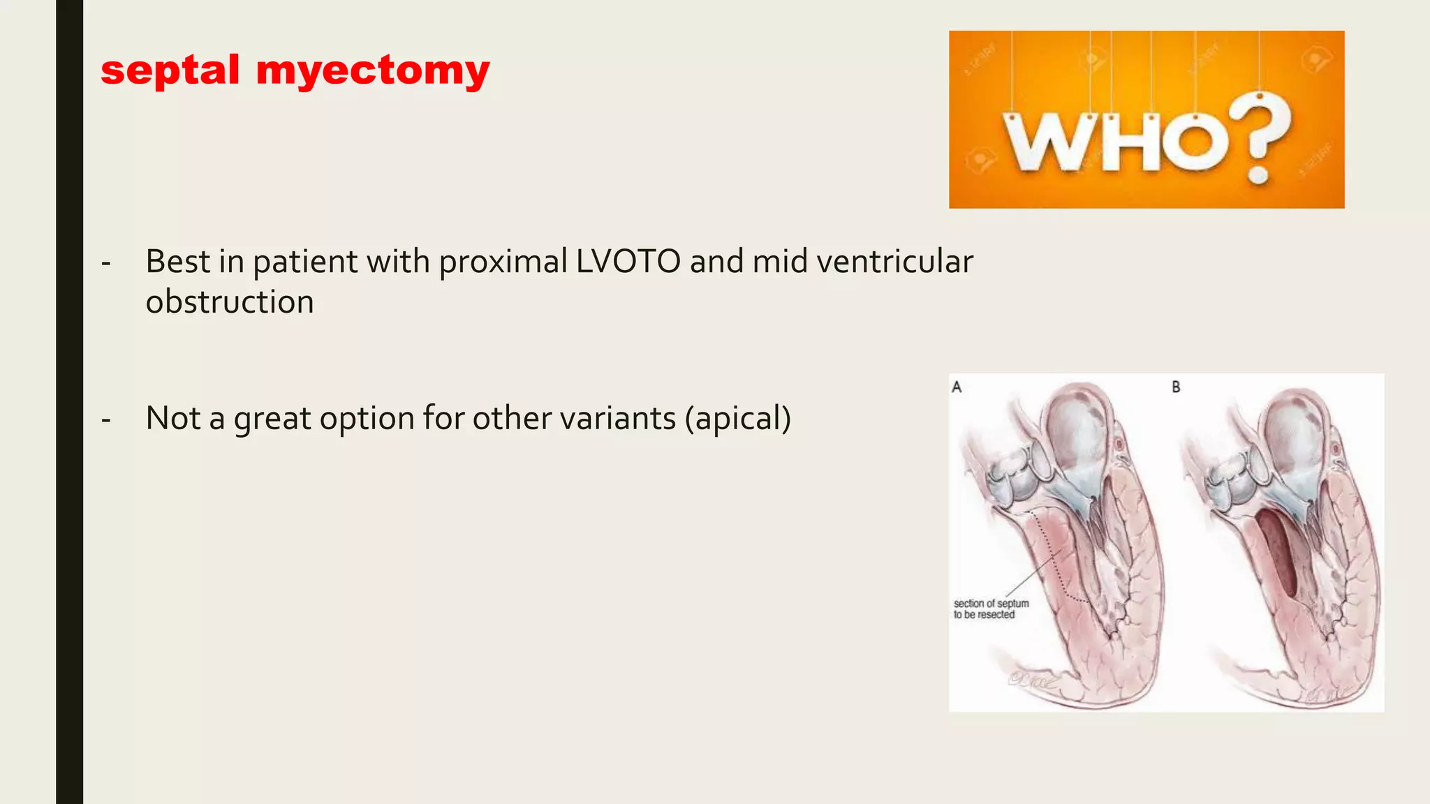 Hypertrophic Obstructive Cardiomyopathy (HOCM) | PPTX
