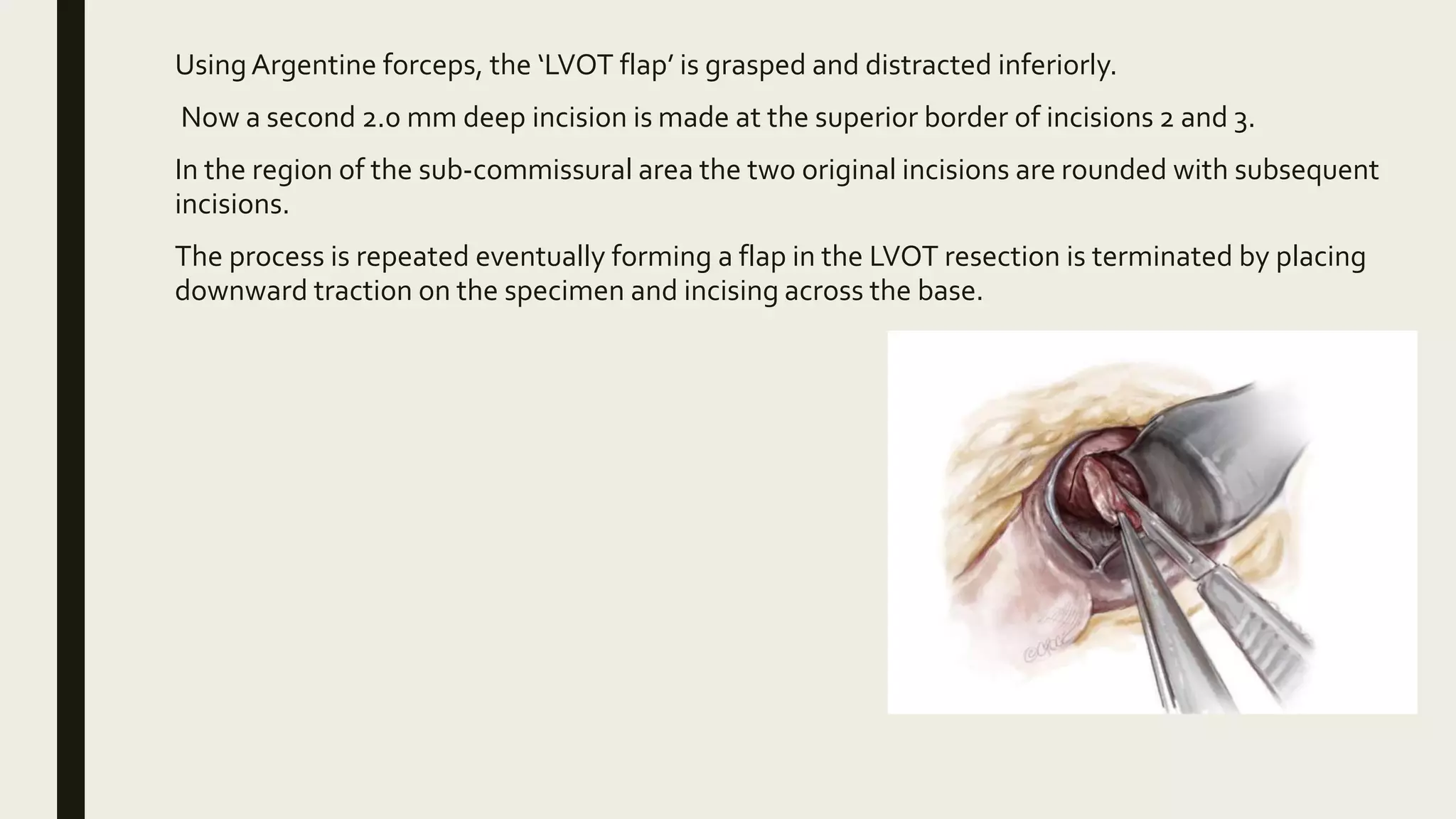 Hypertrophic Obstructive Cardiomyopathy (HOCM) | PPTX