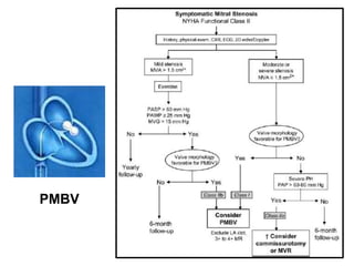 Surgical treatment for mitral valve disorders cv nurses | PPT
