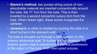 GastroIbtestinal Procedures | PPTX | Digestive Disorders | Diseases and ...