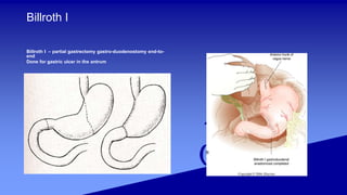 GastroIbtestinal Procedures | PPTX