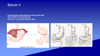 GastroIbtestinal Procedures | PPTX