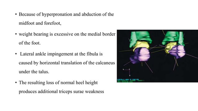 Surgical treatment of CTEV | PPTX