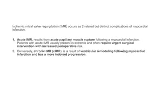 Surgical Treatment of Ischemic Mitral Regurgitation | PPTX