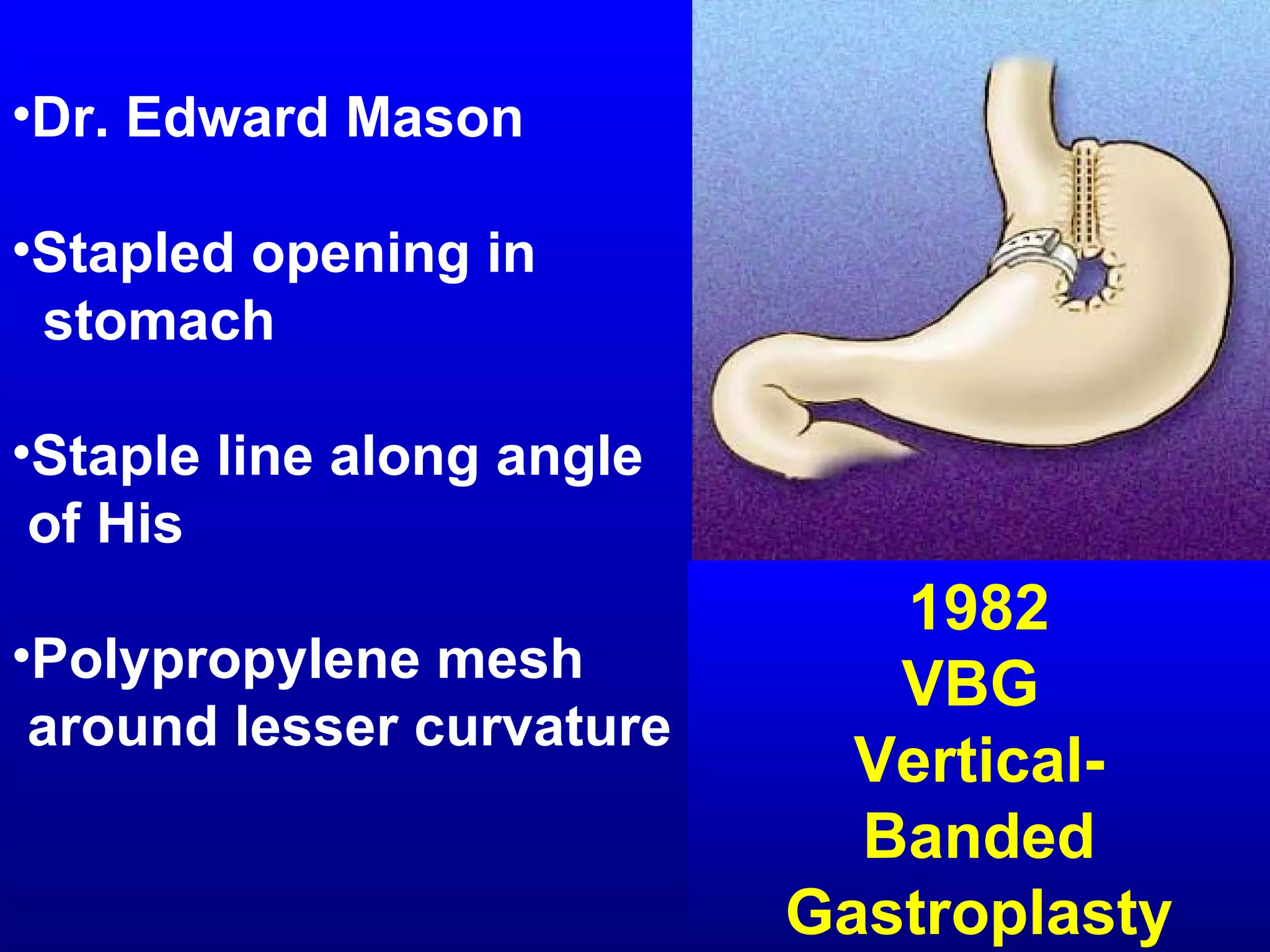 Surgical Treatment of Morbid Obesity | PPT