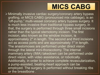 Surgical treatment of myocardial ischemia | PPTX