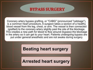 Surgical treatment of myocardial ischemia | PPTX