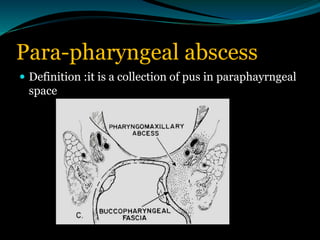 Parapharyngeal Abscess