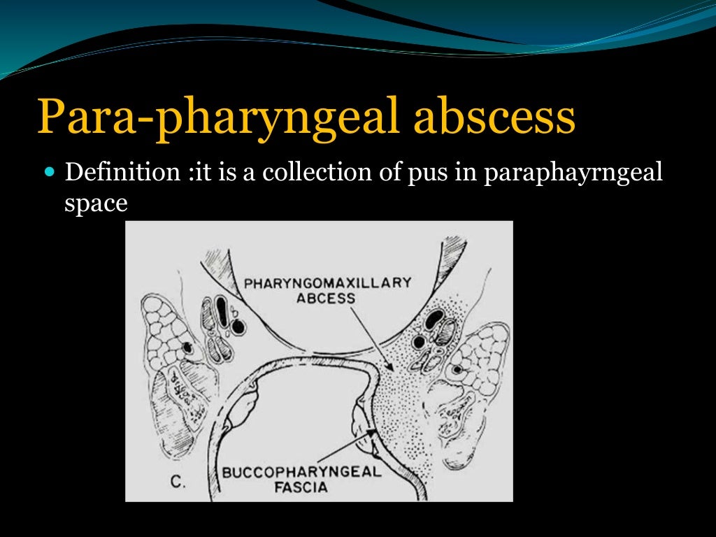 Surgical treatment of paraphyrngeal and retropharyngeal abscesses