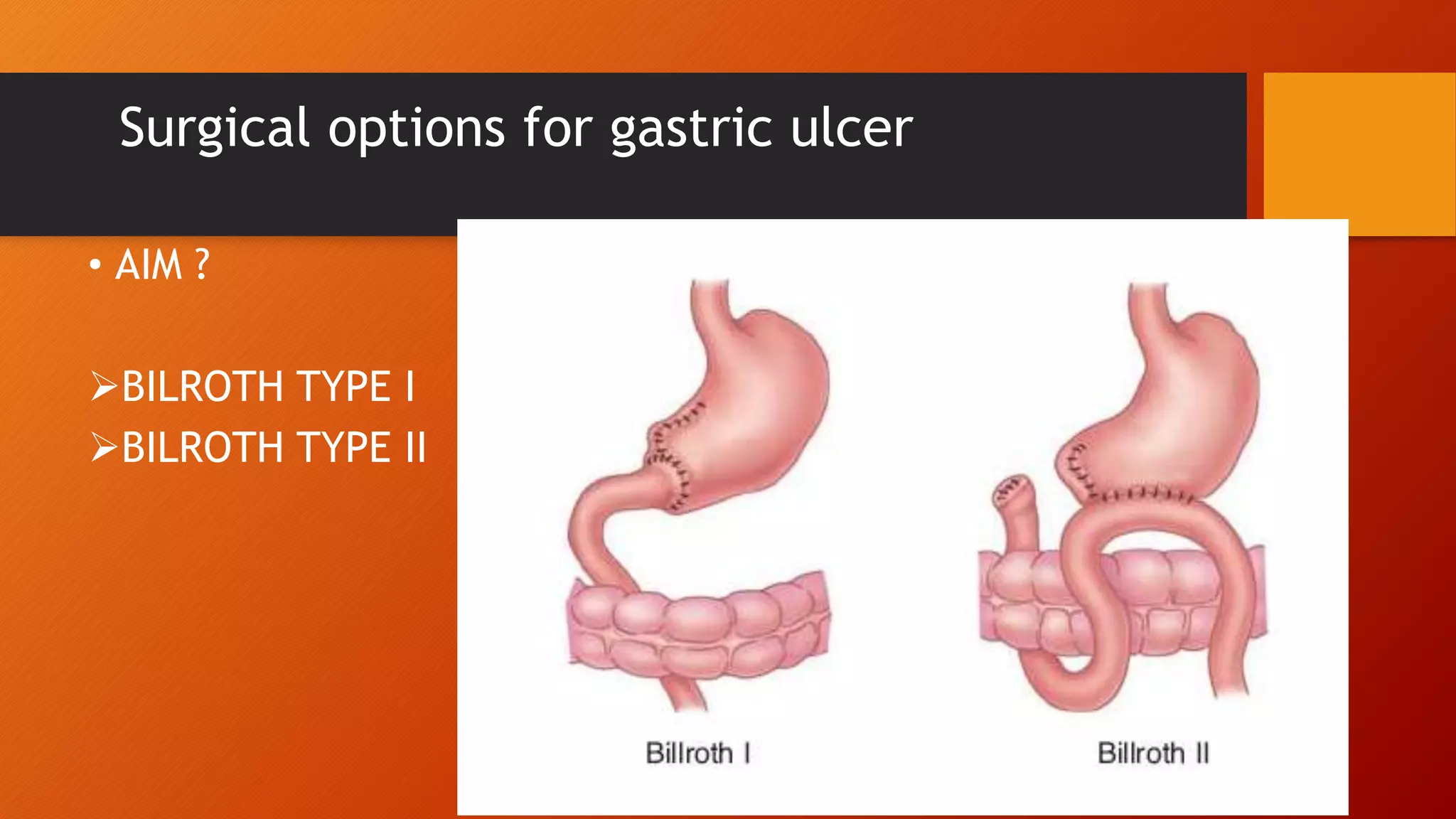 Surgical treatment of peptic ulcer | PPTX