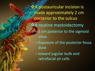 Surgical treatment of peripheral vestibular disorders | PDF