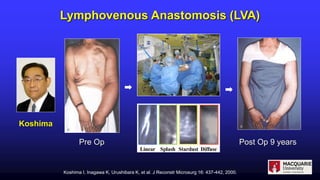 Surgical treatment of secondary lymphoedema—algorythimic approach at MD ...
