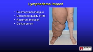 Surgical treatment of secondary lymphoedema—algorythimic approach at MD ...