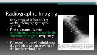 Surgical treatment of spinal TB | PPT