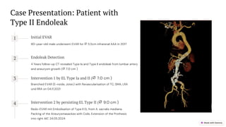 Surgical Treatment of Type II Endoleaks. | PPT