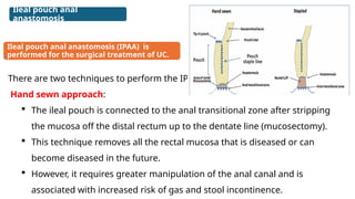 Surgical Treatment of Ulcerative Colitis.pptx