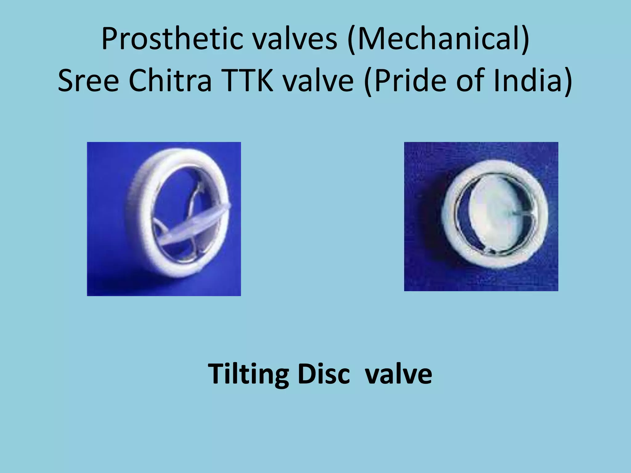 Surgical treatment of Valvular Heart diseases | PPTX