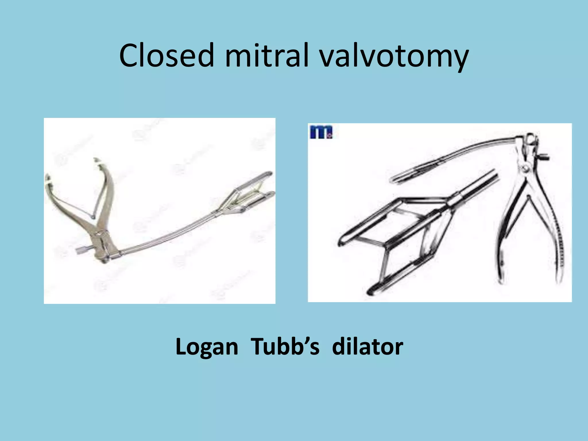Surgical treatment of Valvular Heart diseases | PPTX