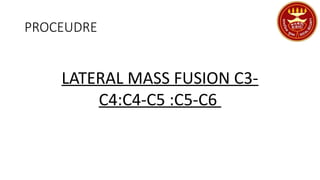 SURGICAL UNIT 1 PALANI C3-C4-C5 with compressive myelopathy.pptx