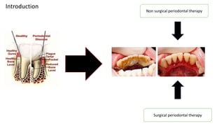 Surgical vs non surgical | PPTX