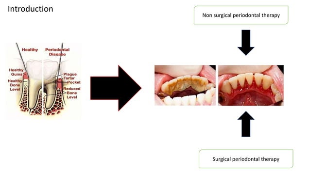 Surgical vs non surgical | PPTX