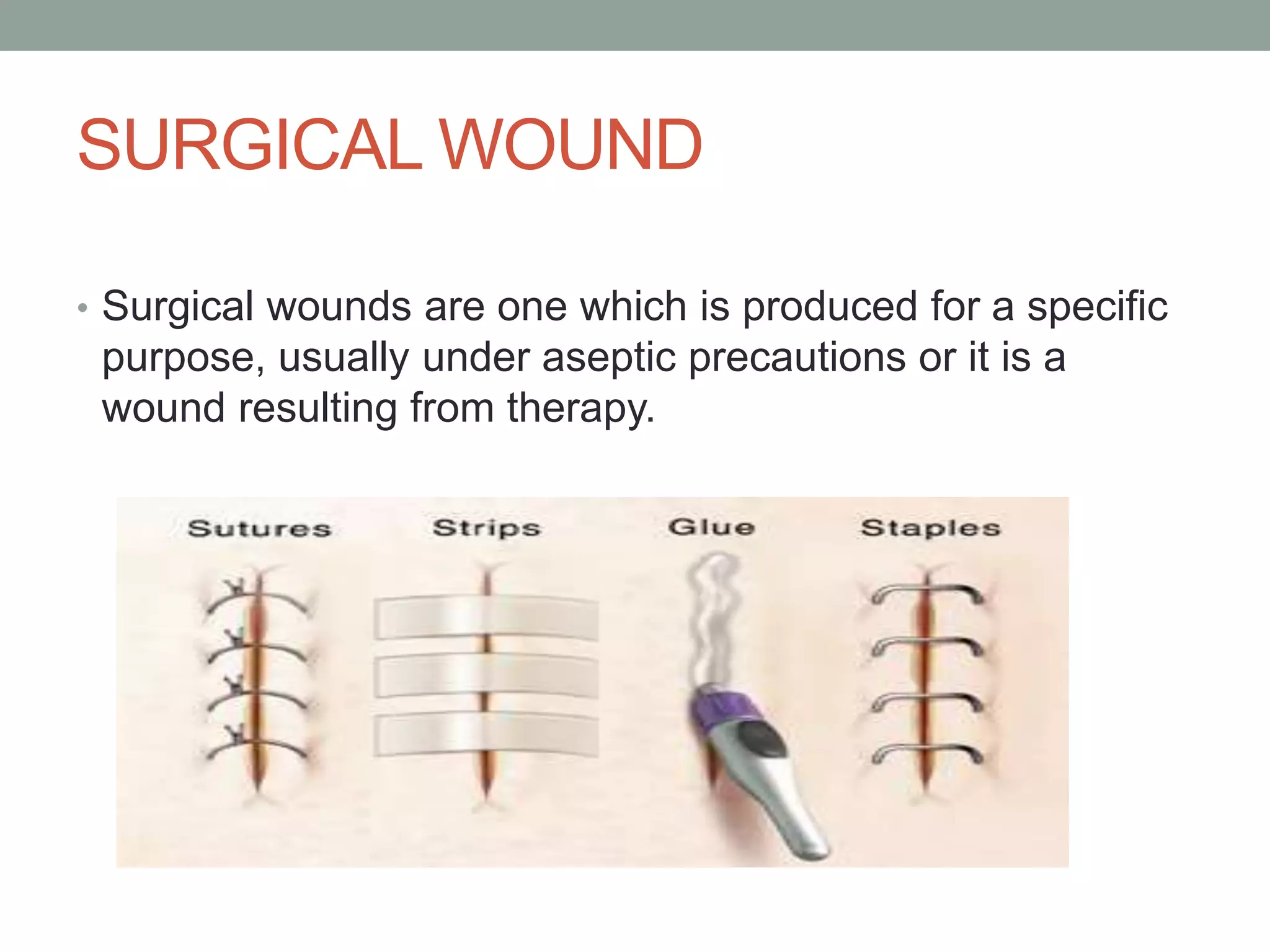 Surgical wound dressing | PPTX