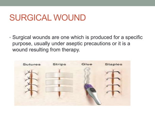 Surgical wound dressing | PPTX