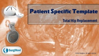 Revision Hip replacement with patient specific instruments real case ...