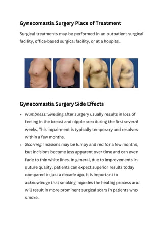 SurgiSculpt Offers the Most Excellent Gynecomastia Treatment.docx
