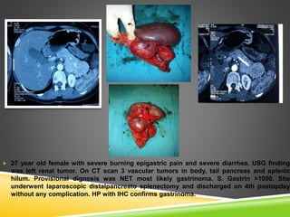 Pancreas Surgical Management | PPT