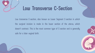 Low Transverse Cesarean Section Power Point Presentationpdf | PDF
