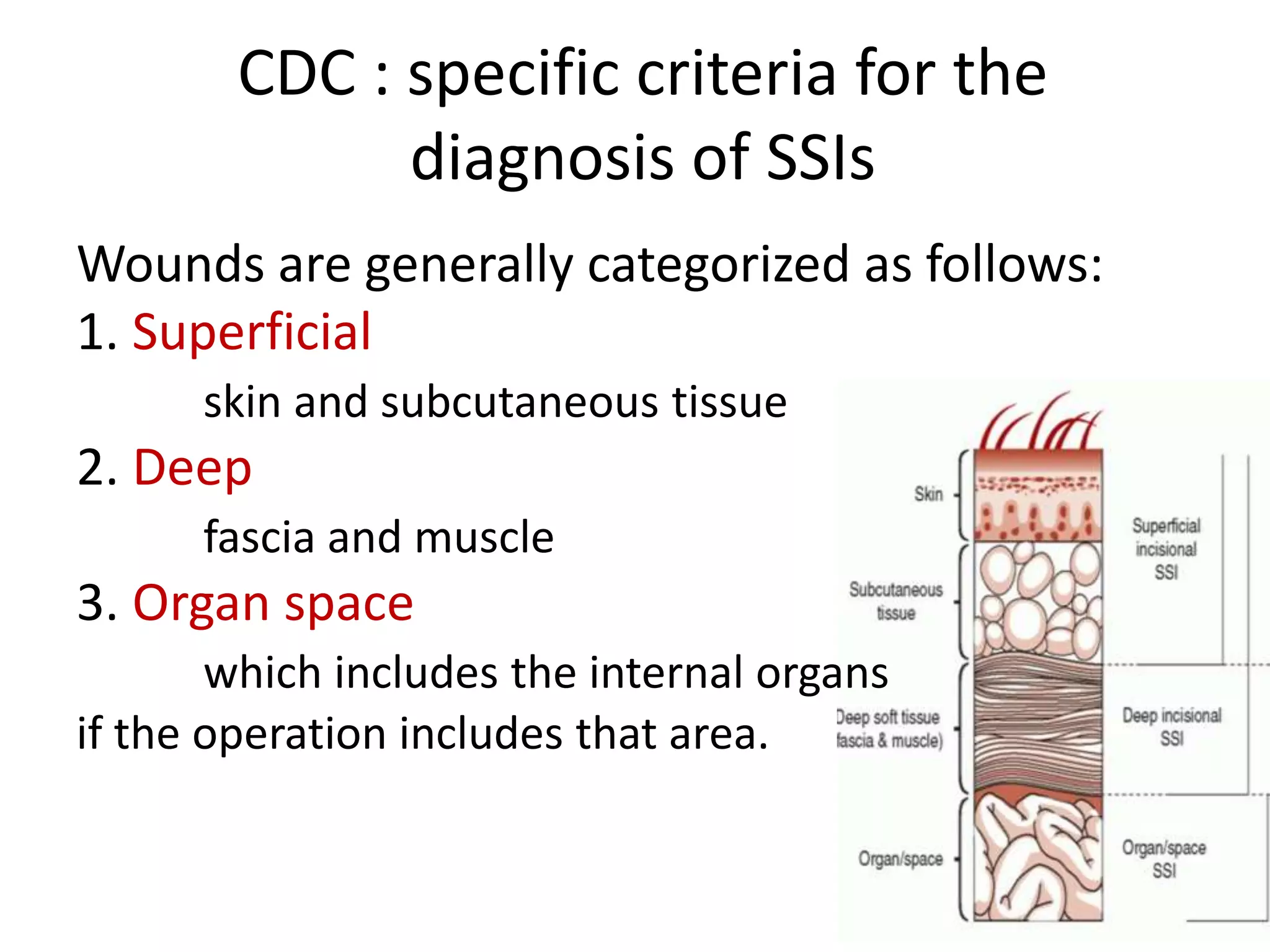 Surgical site infection | PPTX
