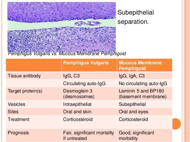Bullous Pemphigoid Vs Pemphigus Vulgaris