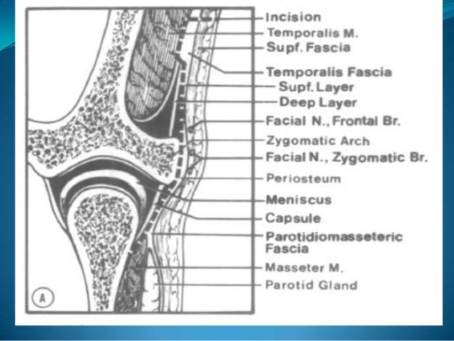 surgical anatomy of TMJ