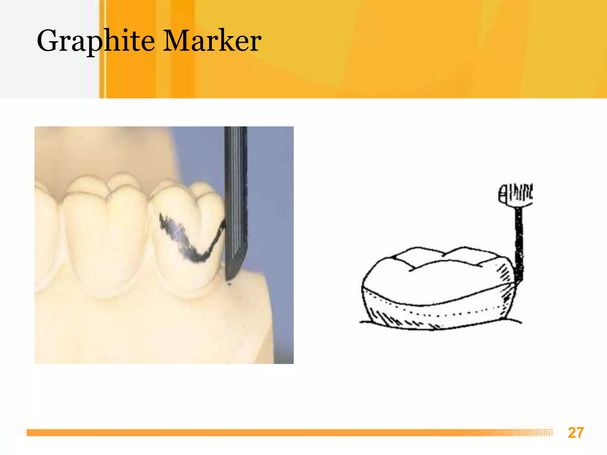 Surveyor and technique of Surveying in Removable partial denture | PPTX