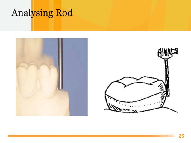 Surveyor and technique of Surveying in Removable partial denture | PPTX